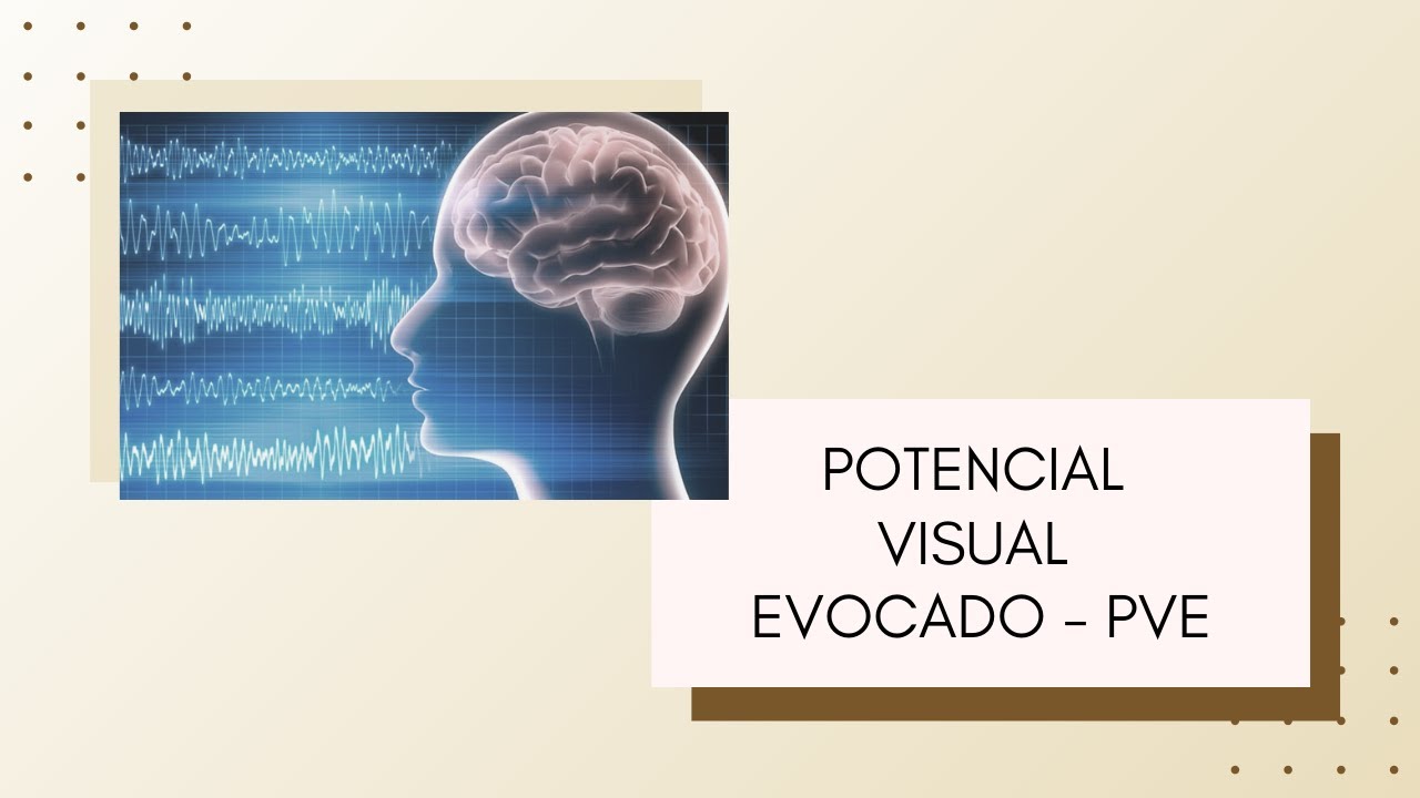 Potencial Visual Evocado - PVE | Dr Emmerson Badaró | Viver ...