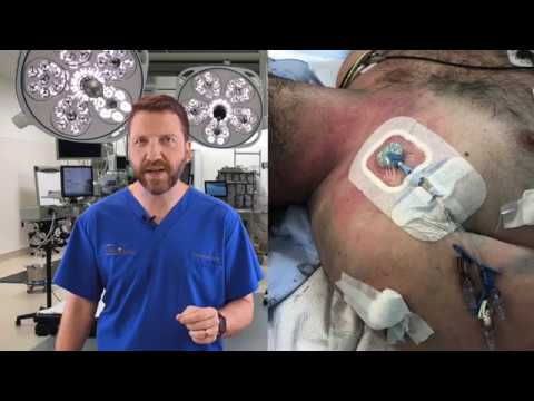 Trauma in a Flash: Central Line Insertion - YouTube