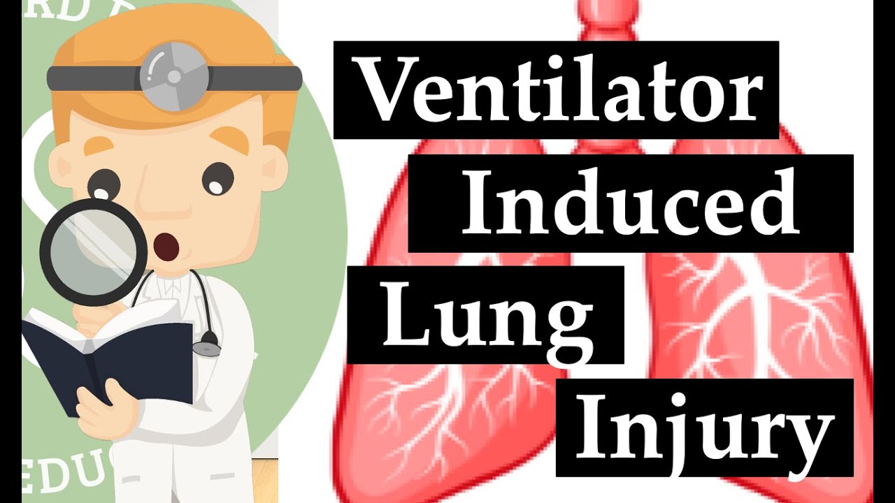 Mechanical Ventilation Basics - Ventilator Induced Lung Injury (VILI ...