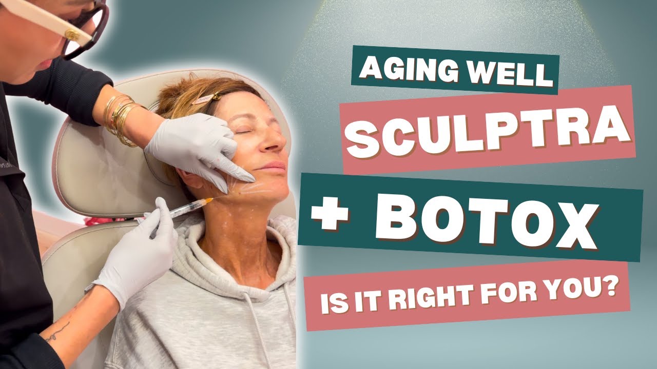 Sculptra vs Botox? Or BOTH? The Ultimate Anti-Aging Combo - YouTube