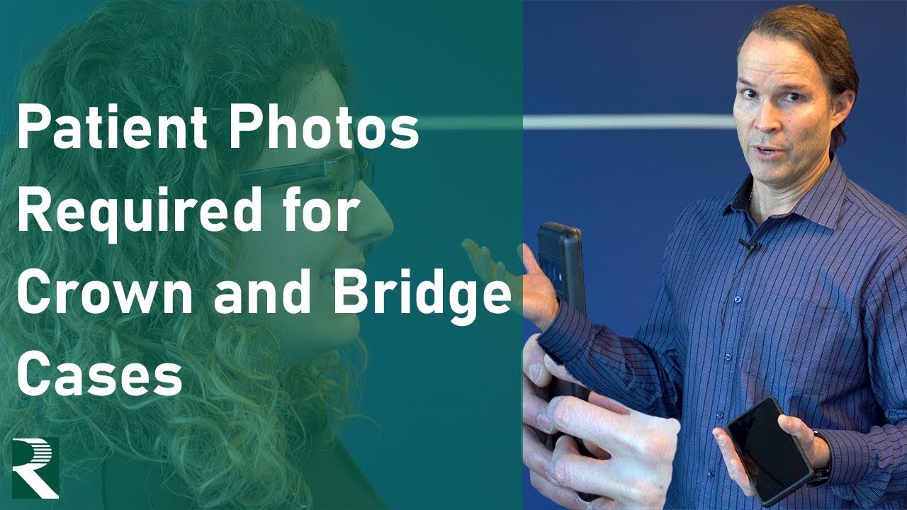 The Required Patient Photos For Crown And Bridge Cases YouTube the-required-patient-photos-for-crown-and-bridge-cases-youtube
