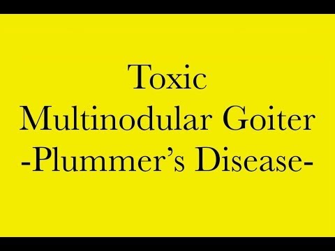 Pathology: Toxic Multilobular Goiter -Plummer's Disease- - YouTube