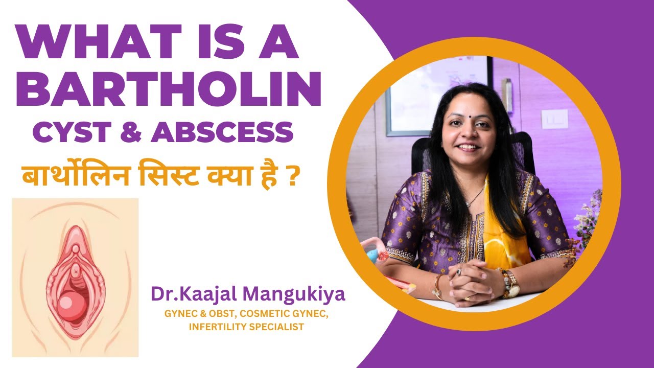 What is a Bartholin cyst & Abscess ? | बार्थोलिन सिस्ट क्या है ? | Dr ...