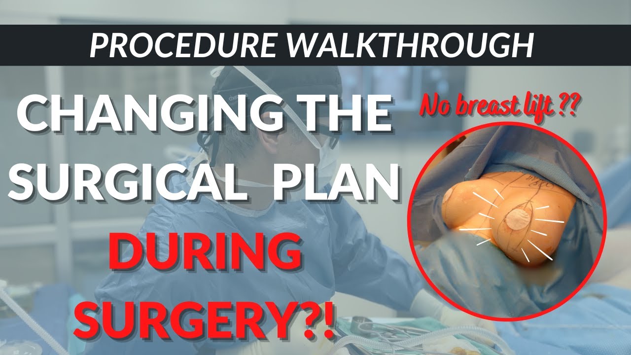 We Changed the surgical plan from breast augmentation and a lift to ...