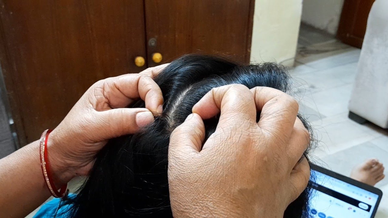 😊🌜 Full head checking Video | Scalp checking | Hair Oiling ️ ️ - YouTube