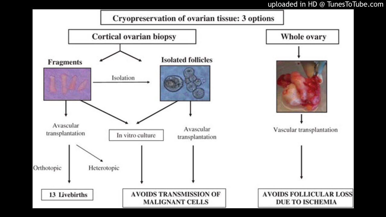 Ovarian tissue cryopreservation and transplantation using thawed ...