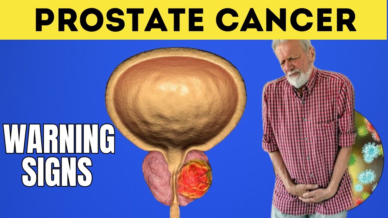 Prostate Cancer Signs | Warning Signs of Prostate Cancer - YouTube