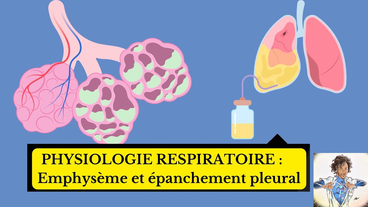 PHYSIO RESPI - EMPYÈME ET ÉPANCHEMENT PLEURAL - YouTube