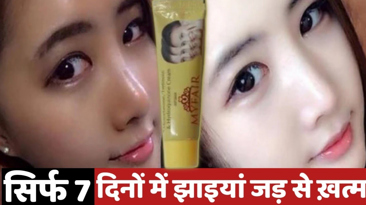 my-fair-cream-review-in-hindi-youtube