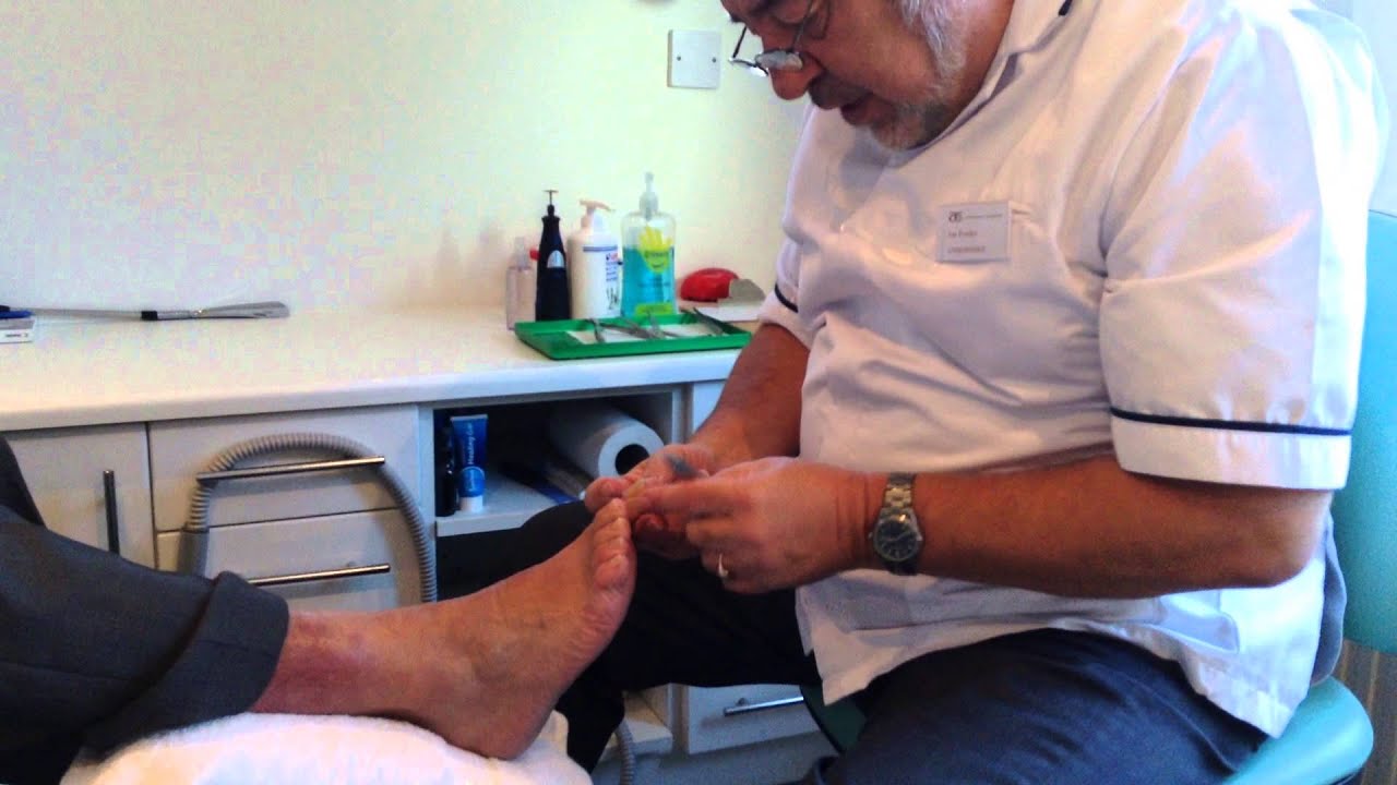 Ian Fowler, Chiropodist at The Therapy Company demonstrates his work ...