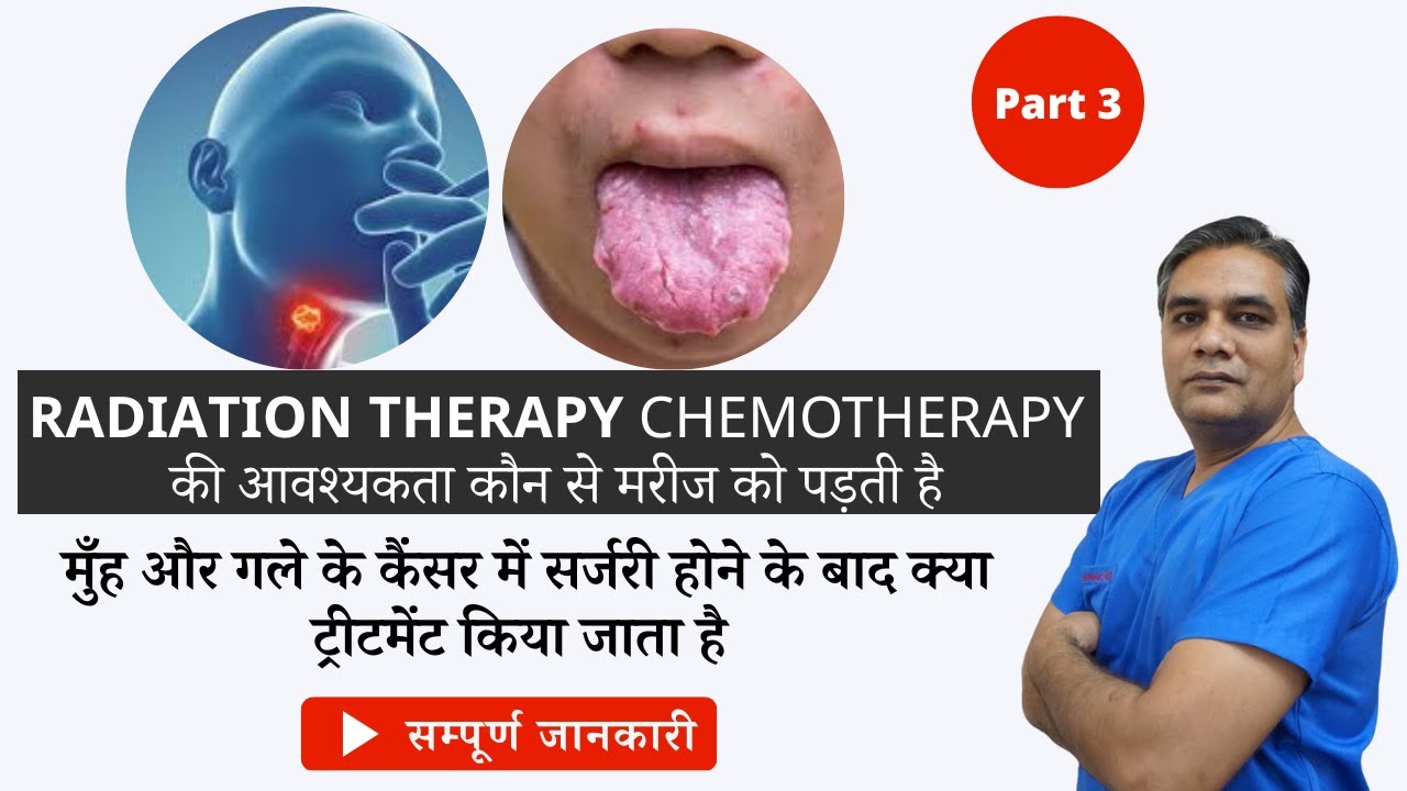 Oral Cancer Treatment | Role of Radiation Therapy & Chemotherapy in ...