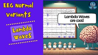 Lambda Waves - Normal EEG Basics.