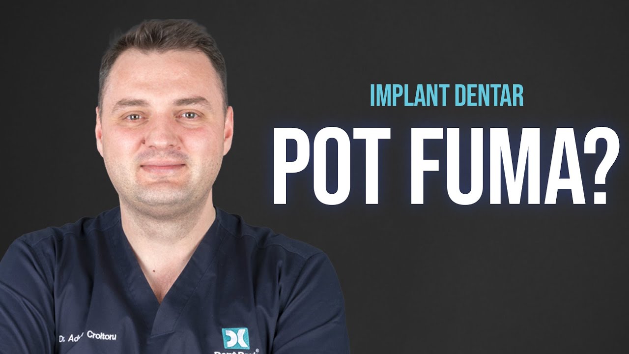 București | POT FUMA DUPĂ INSERAREA IMPLANTULUI DENTAR? | Află acum de ...