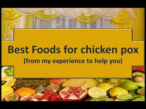 FOODS FOR CHICKENPOX