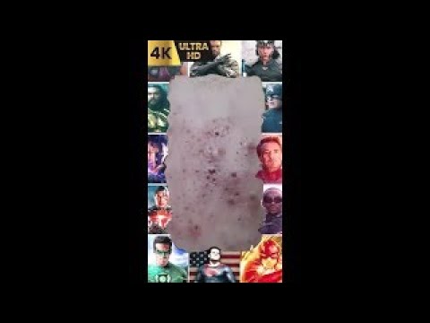 Blackheads Removal | Acne Treatment and Very Satisfying Satisfying ...