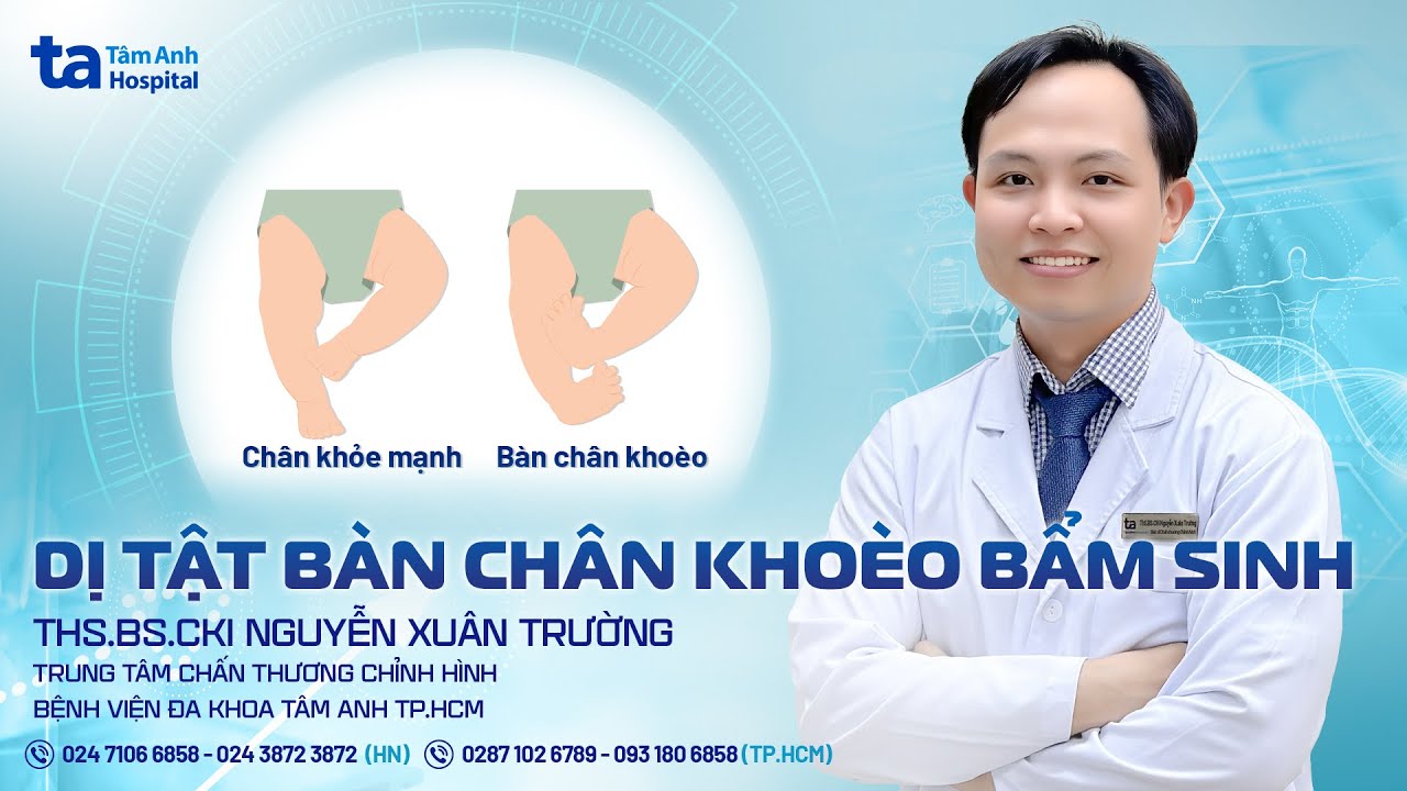 Dị tật bàn chân khoèo bẩm sinh: Nguyên nhân và cách điều trị | CTCH Tâm ...