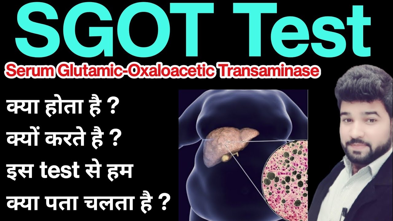 SGOT Test | Serum Glutamic Oxaloacetic Transaminase | SGOT Full Form ...