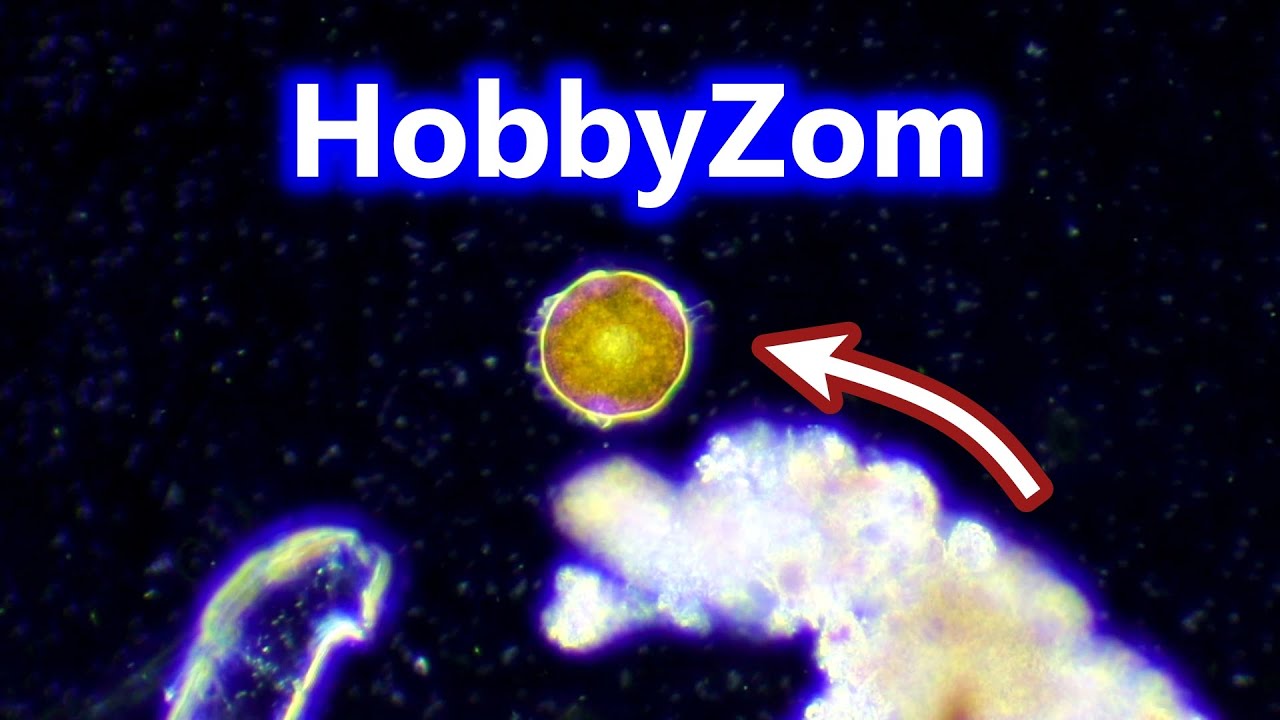 Movement patterns of a TESTATE AMOEBA - Olympus BH2 BHT - YouTube