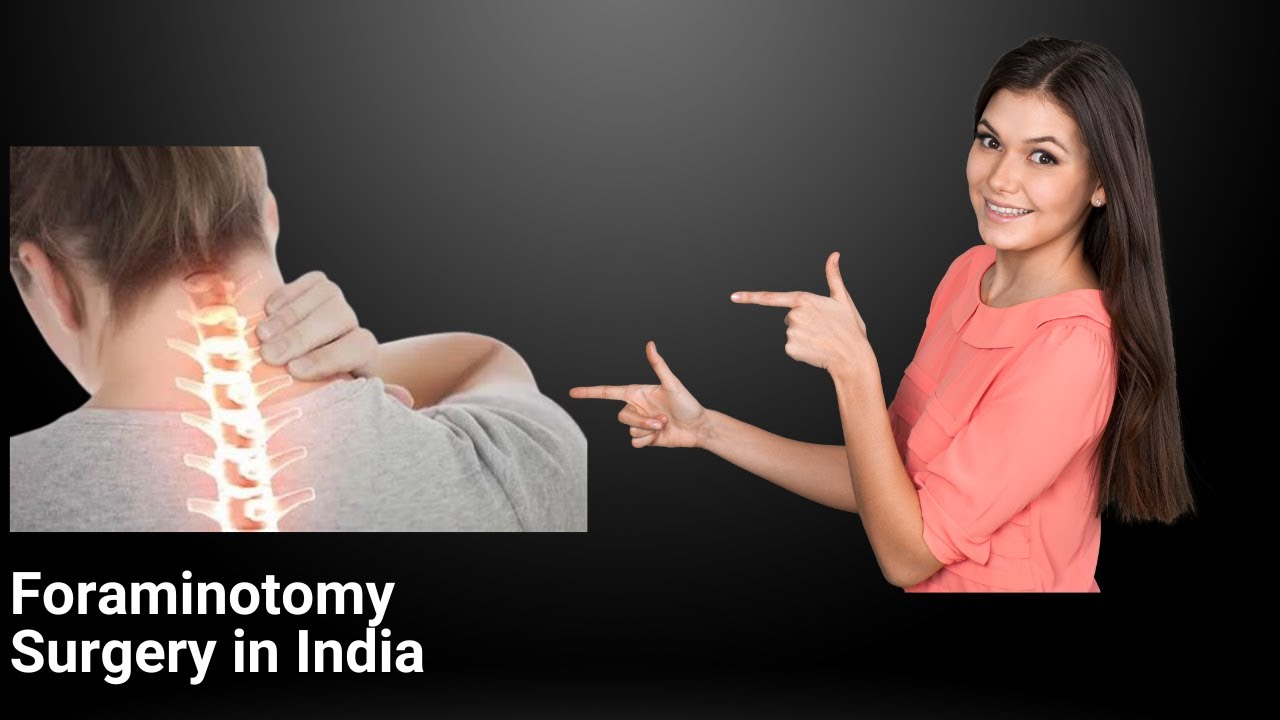 Discover the Benefits of Foraminotomy Surgery in India | Expert Care at ...