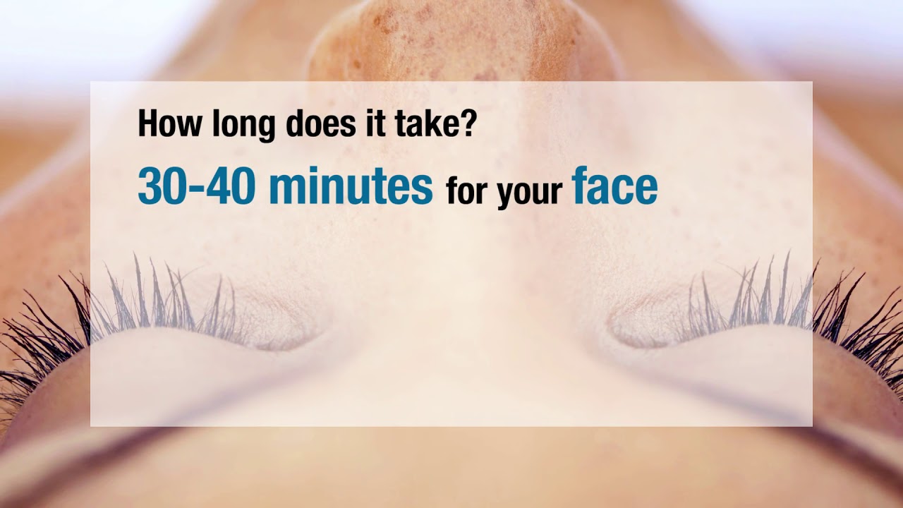 How Microdermabrasion Works – The Basics - YouTube