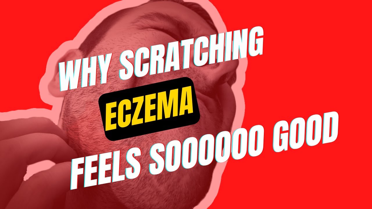 Why Scratching Eczema Feels Good (and How to Relieve The Itch) - YouTube