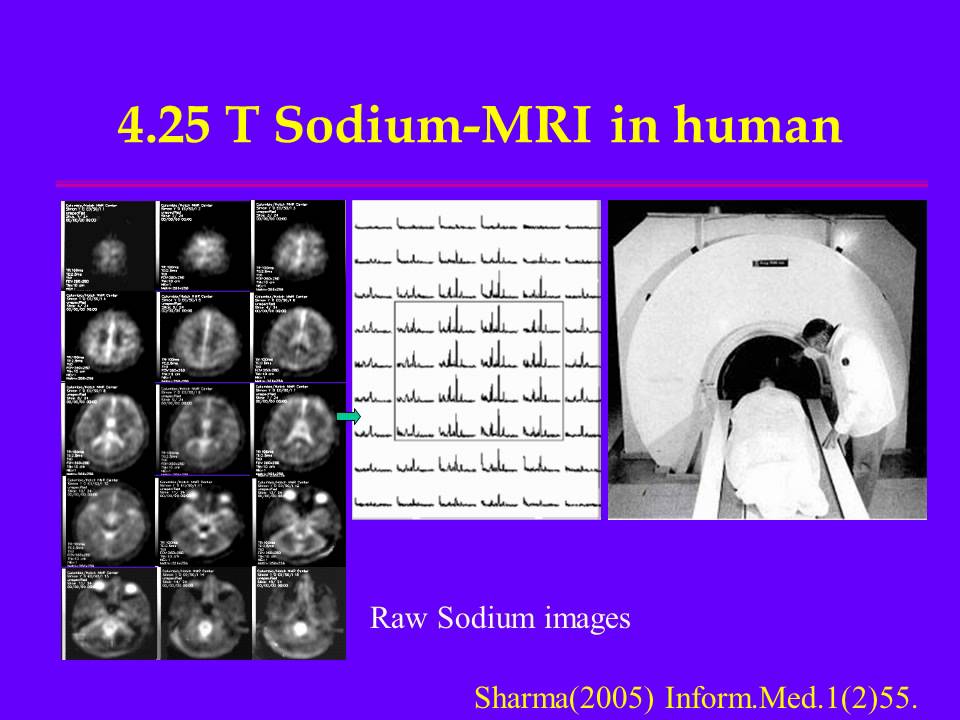 MR Spectroscopy and Imaging: Lectures and Teaching Project.wmv - YouTube