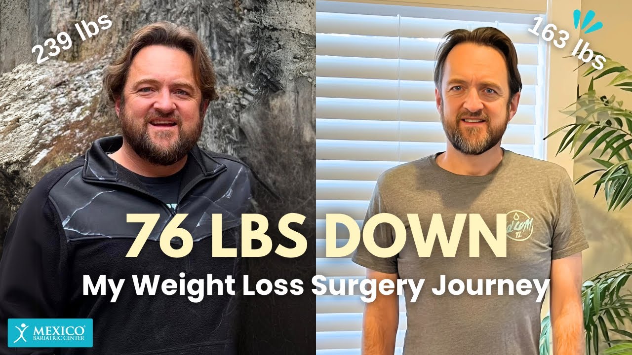 I LOST 76 POUNDS! | Sharing my Weight Loss Journey with Duodenal Switch ...