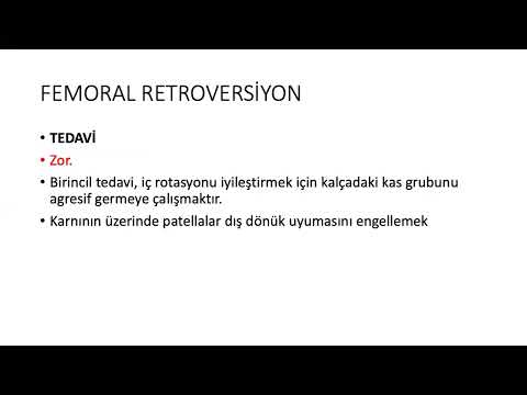 Kalça rotasyon sorunları ve tedavisi 