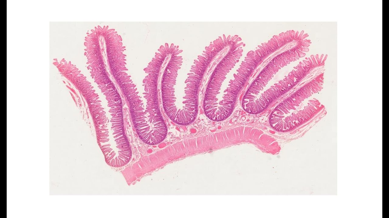 Mucosa of the Intestinal Villi Tissue Identification - YouTube