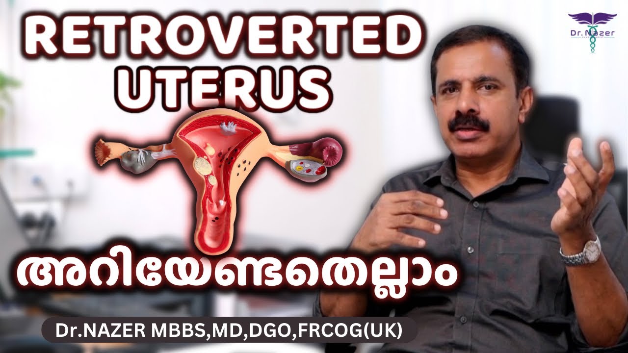 Retroverted Uterus അറിയേണ്ടതെല്ലാം | MALAYALAM | Dr NAZER - YouTube