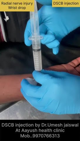 INJ DSCB BY DR UMESH JAISWAL IN RADIAL NERVE INJURY WRIST DROP #pain # ...