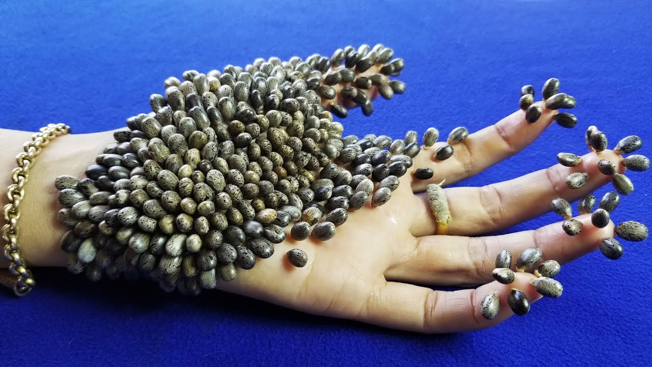 Remove strange ticks on hand - YouTube