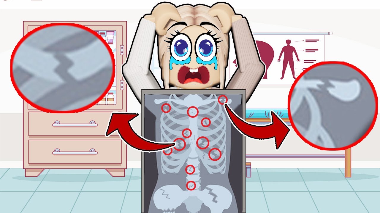 I Break Every Bone In My Body!|Roblox Broken Bones - YouTube