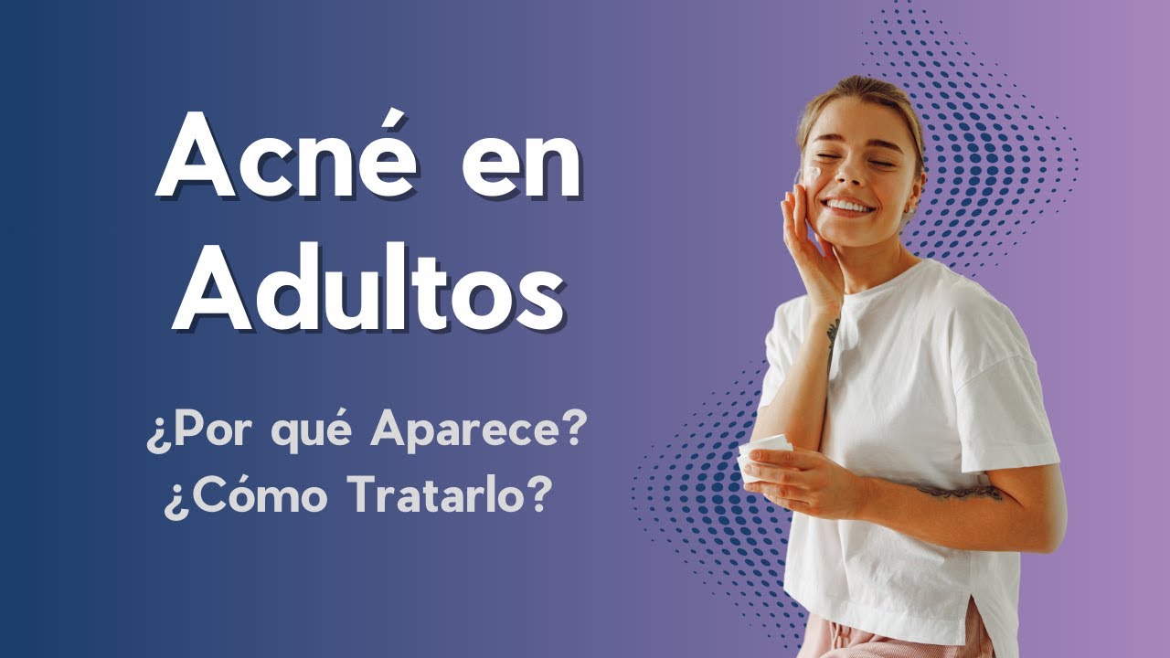 Acné en adultos: ¿Por qué aparece y cómo tratarlo? - YouTube