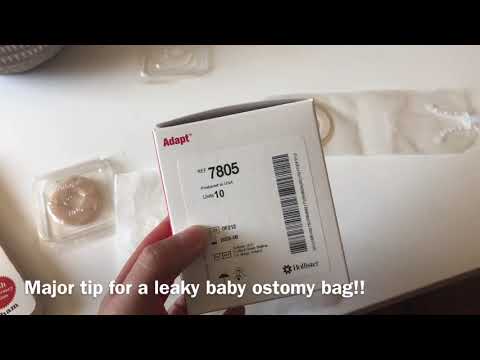Leaking baby ostomy trick! - YouTube