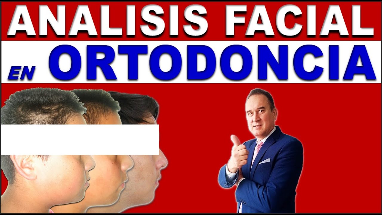 VALORACION 𝗗𝗘𝗟 PERFIL FACIAL 𝗘𝗡 ORTODONCIA - YouTube