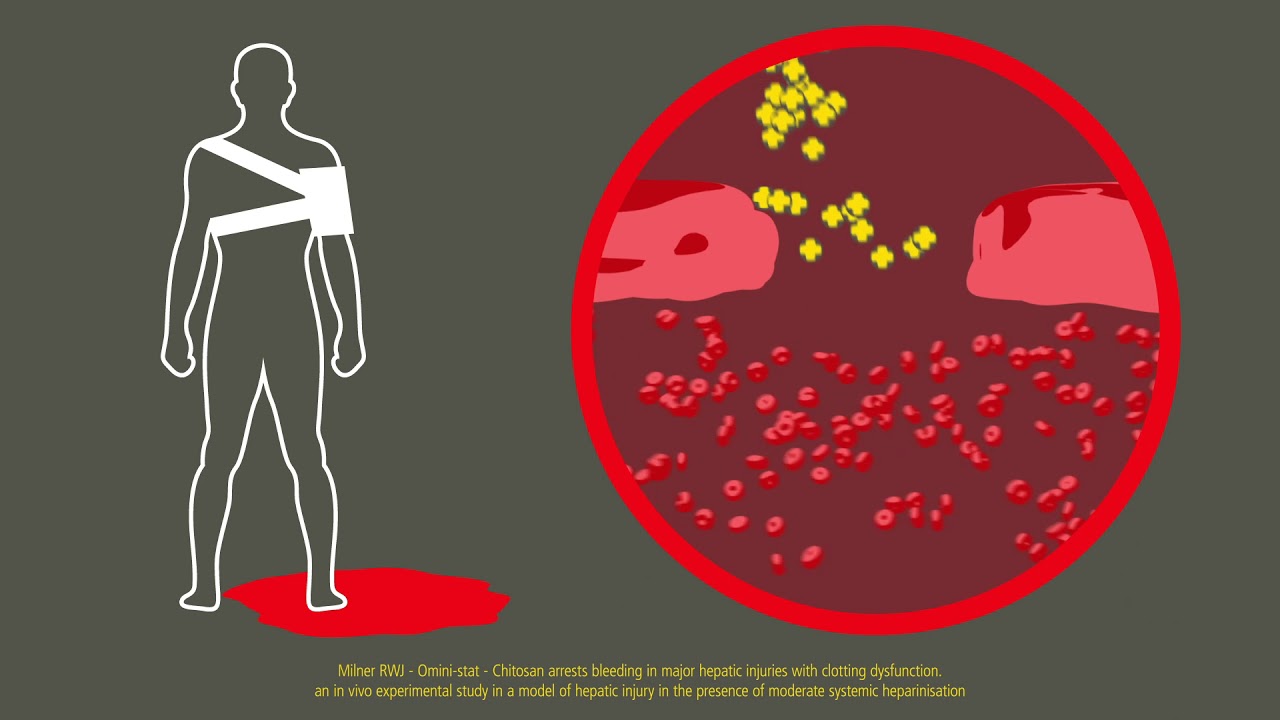 Celox Applicator Training Video – Military emergency response (USA ...