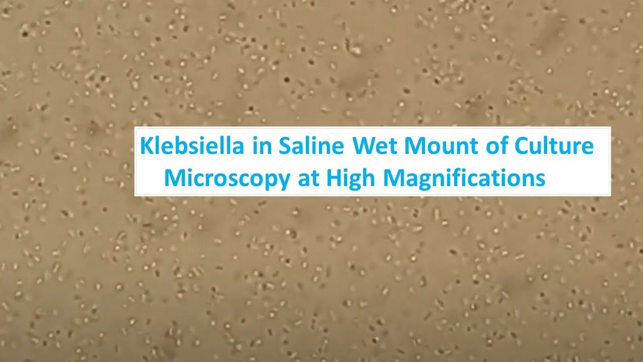 Klebsiella in Wet Mount Microscopy - YouTube