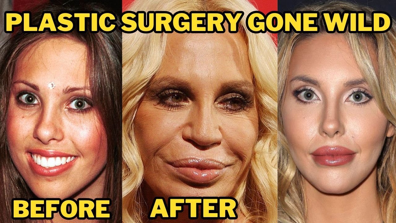 Top 5 Female Celebrities Whose Plastic Surgery Went Wrong | Mind Mosaic ...