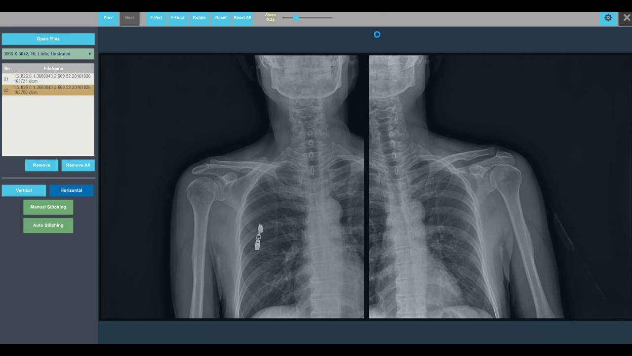 Auto Stitching for Both Shoulder - YouTube