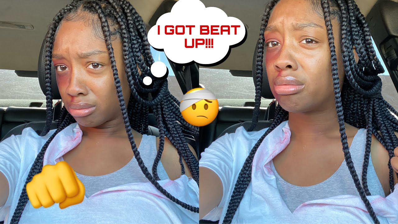 I GOT BEAT UP PRANK ON BOYFRIEND! 🤕 - YouTube