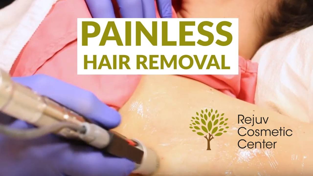 Painless Hair Removal Motus AX Laser - Rejuv Cosmetic Center NJ - YouTube