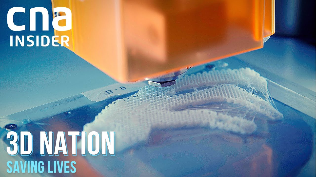 How 3D Printed Body Parts Are Transforming Medical Practice | 3D Nation ...
