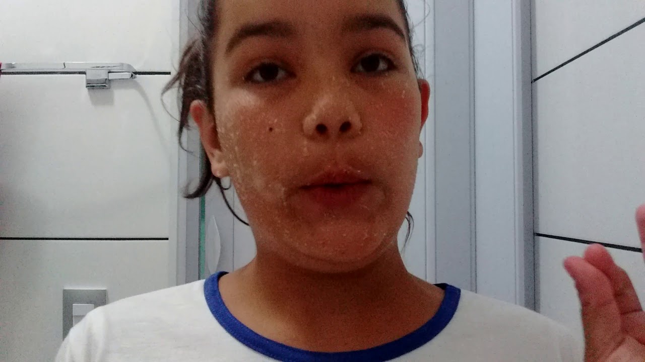 Sua pele está descascando? Pronto resolva seu Problema - YouTube
