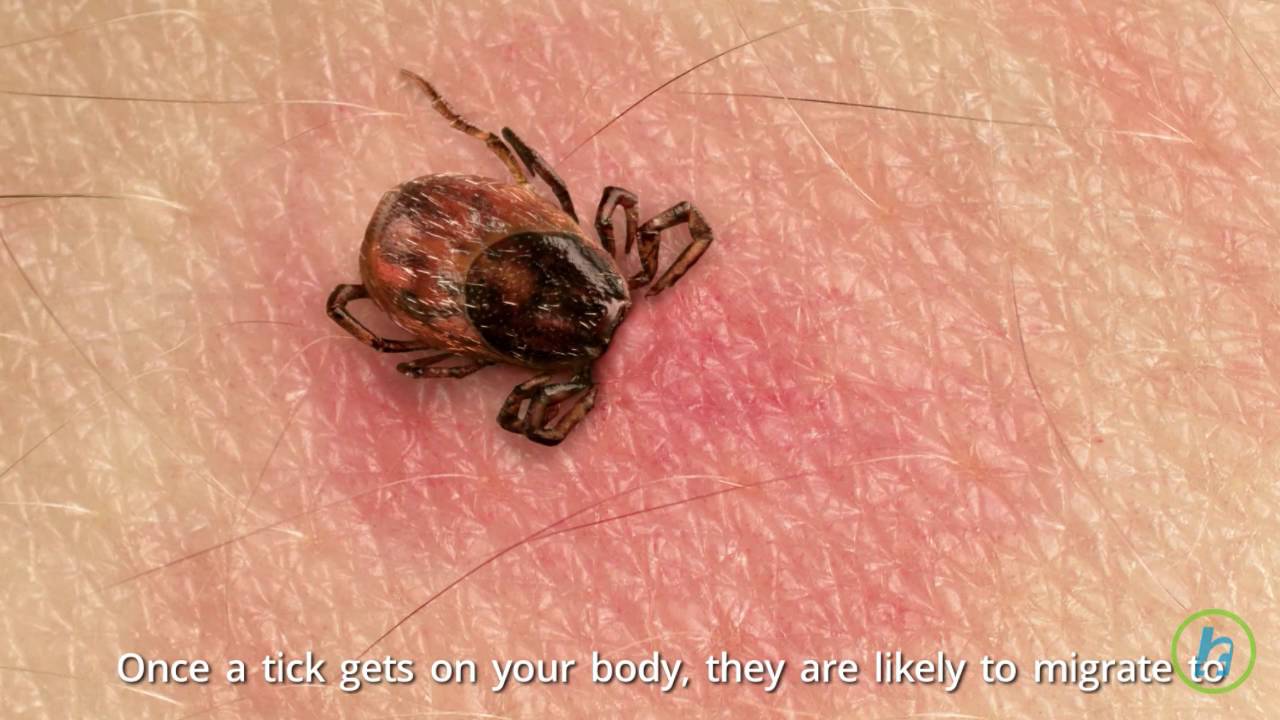 Risks of Tick Bites - YouTube