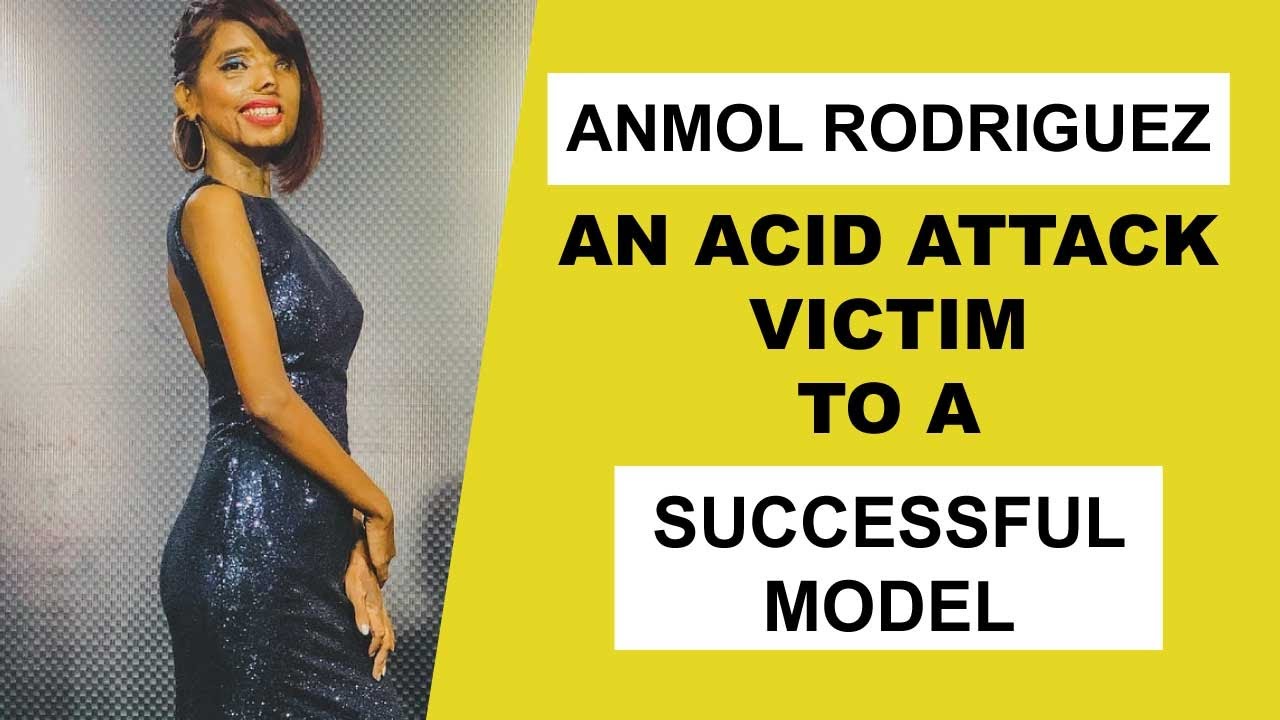 Most Inspirational Story: An Acid Attack Victim To A Successful Model ...