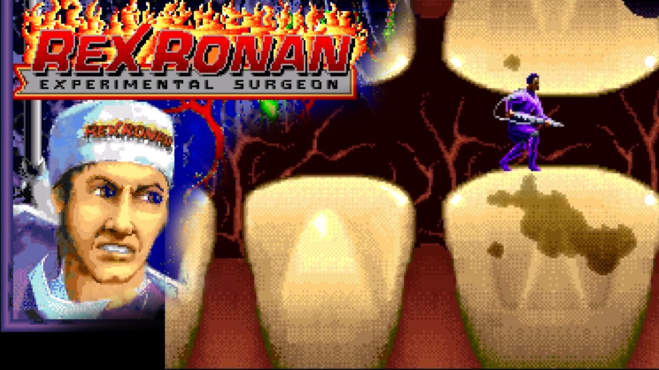Rex Ronan: Experimental Surgeon ... (SNES) 60fps Gameplay - YouTube