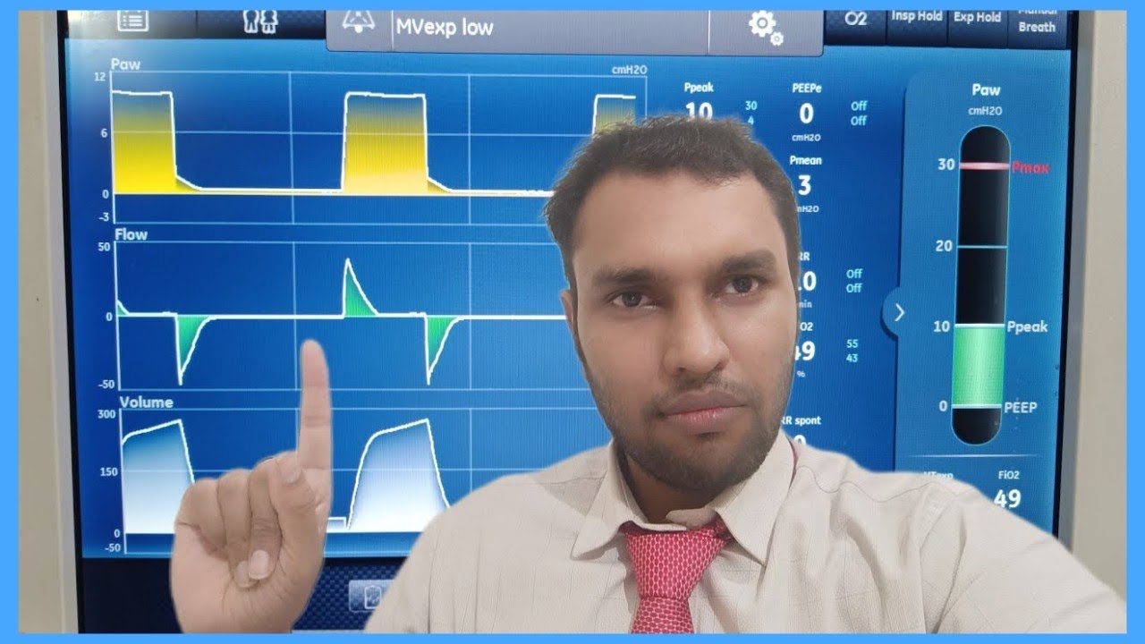 What is Airway Pressure Release Ventilation | APRV mode FT.GE Carescape ...