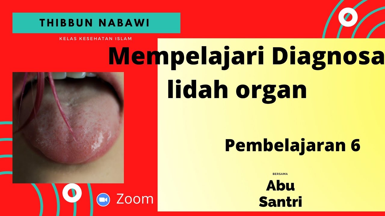 Diagnosa Organ lidah dr sifat warna dan parit pembelajaran 6 - YouTube