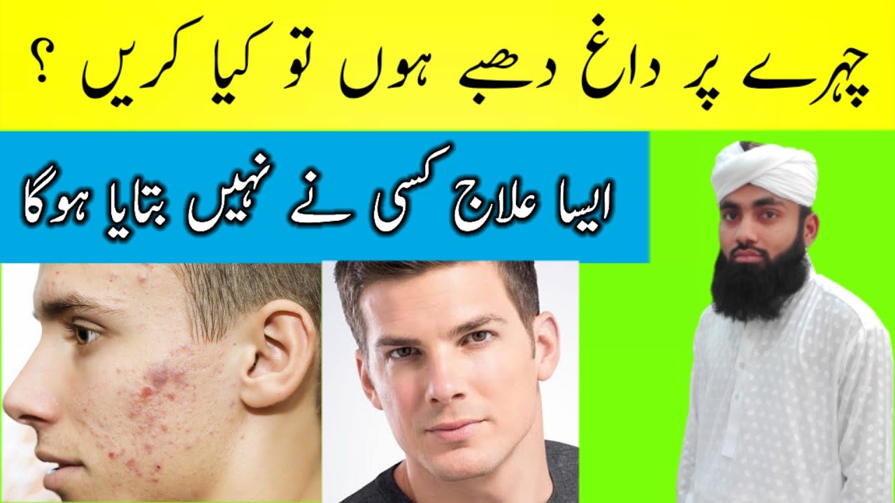 Chahre Par Daag Dhabbe Ho To Kya Karein ? | Wazifa For Face Beauty ...